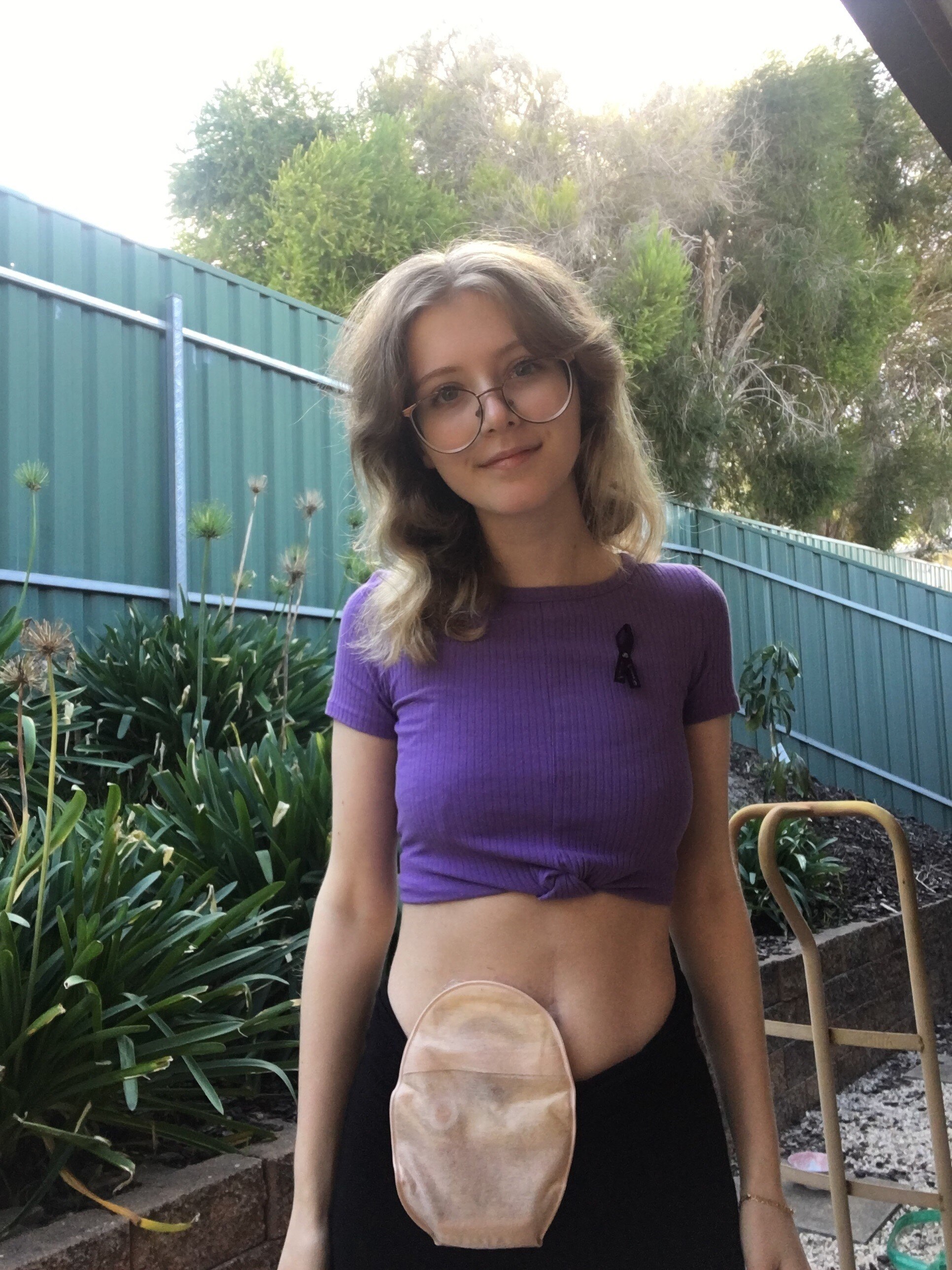 Amelia's story is proof that life can still be good without a large ...