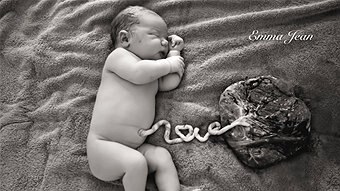 Babytalk: Umbilical Cords - ABC Radio