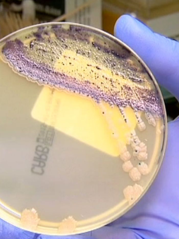 New KPC superbug linked to deaths in Victoria will be hard to combat ...