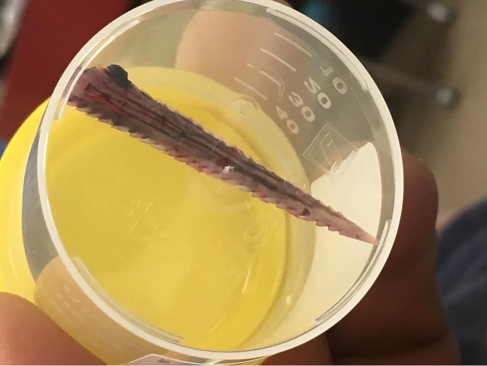 Stingray attack prompts call for change about who can give pain relief ...