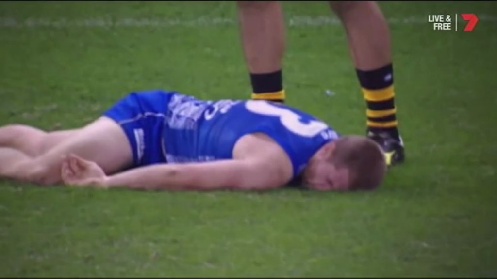 AFL funds first comprehensive study into brains of retired football ...