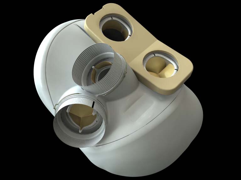 Man survives first week with artificial heart after world-first ...