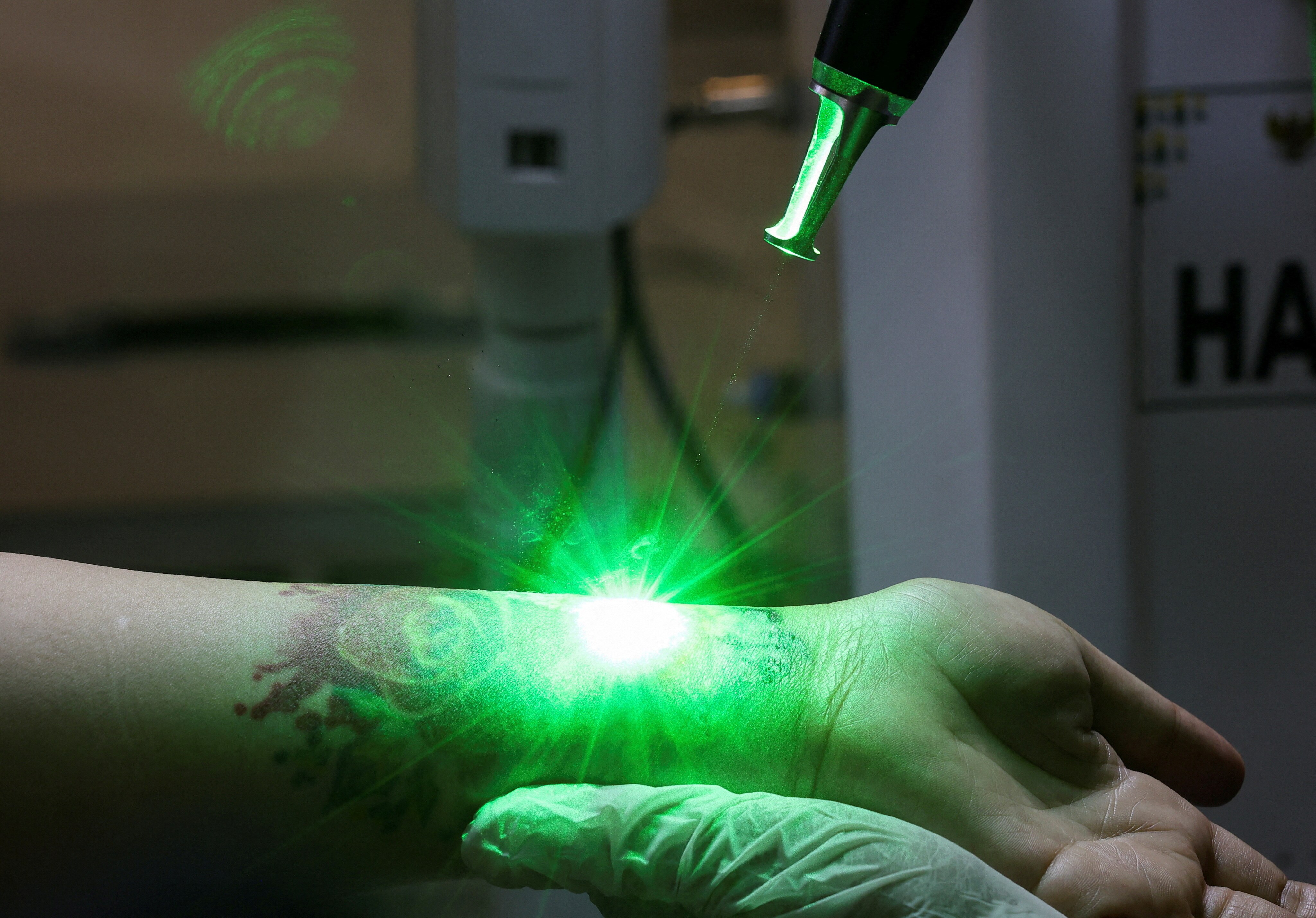 Indonesian Muslims sign up for tattoo removal 'to repent' during ...