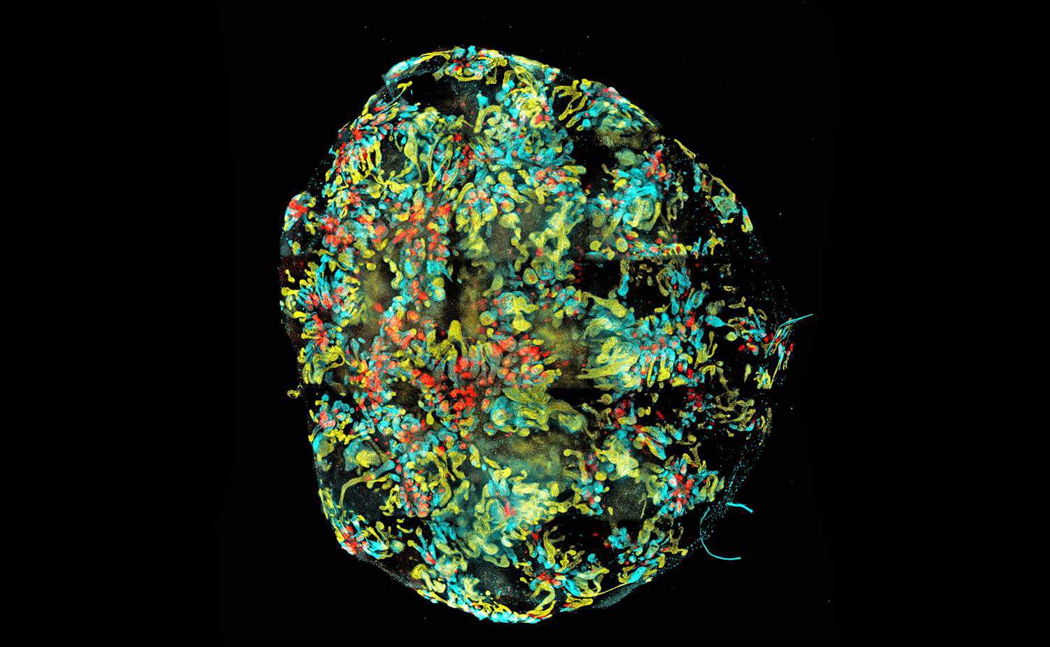 Kidneys in a dish: Scientists reprogram adult skin cells to make mini ...