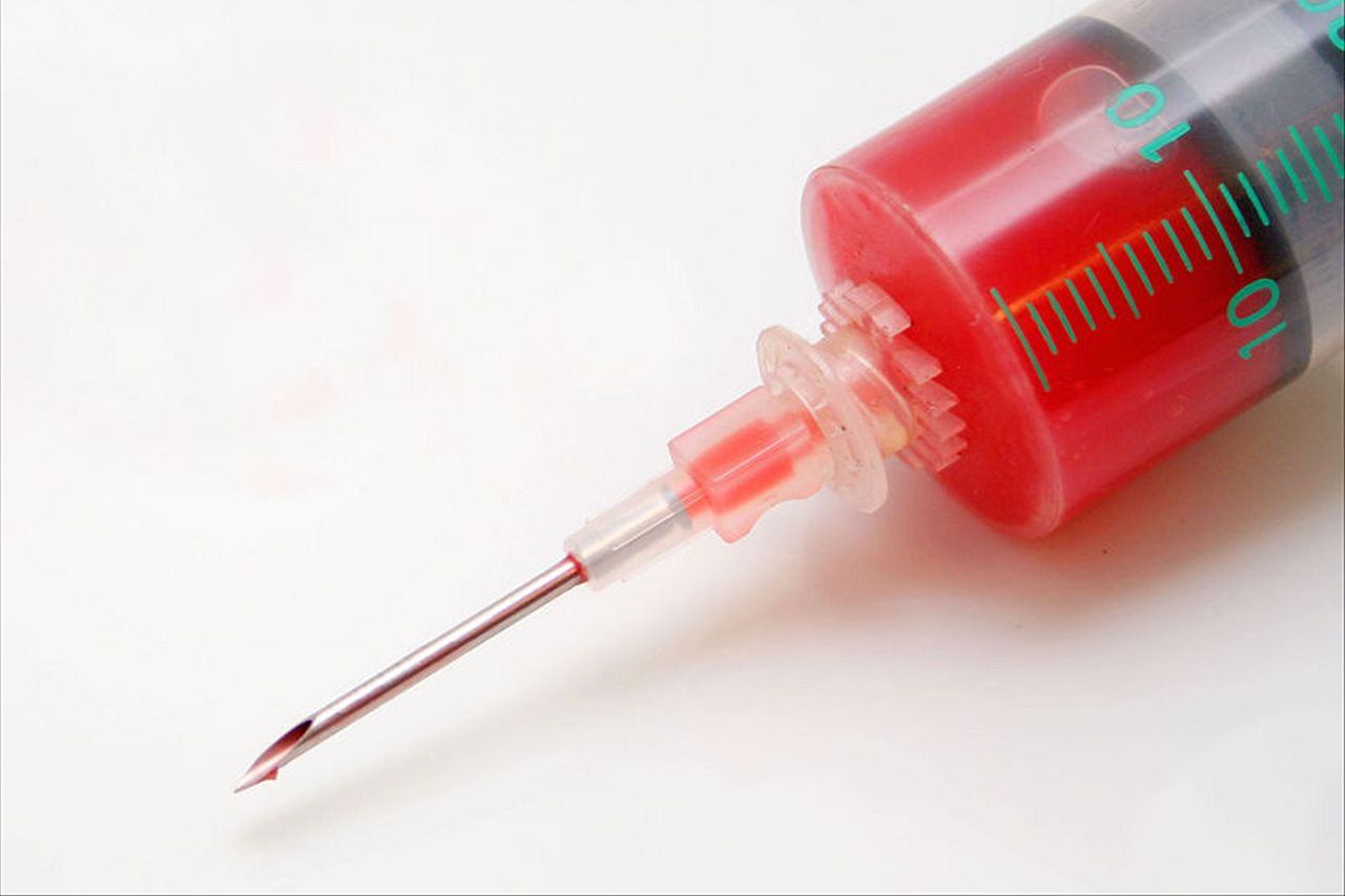 Prenatal screening advances with non-invasive blood test now available ...