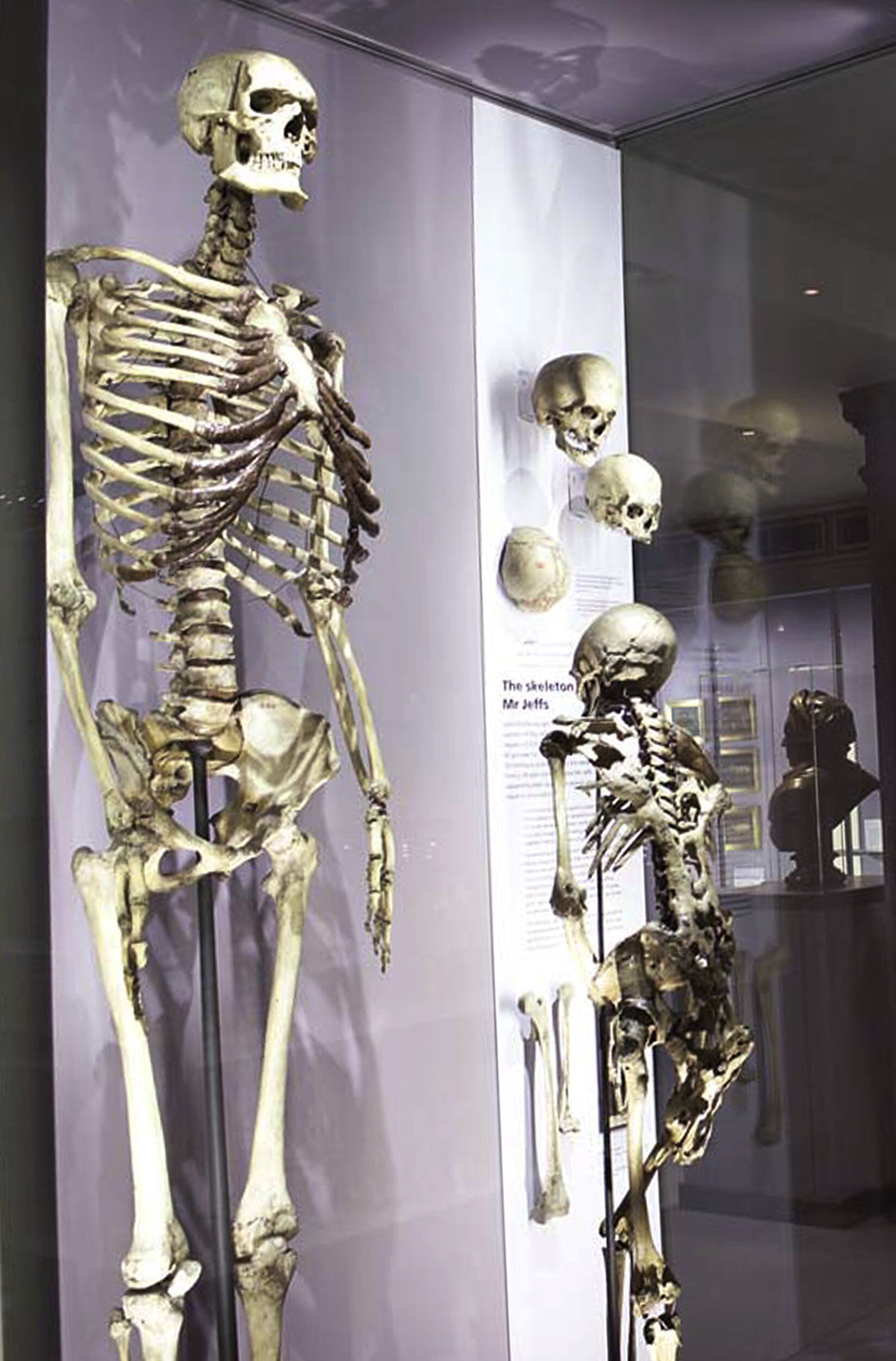 Giant Human Skeleton Museum Pickled Toads And Dodo Bones — Ernest