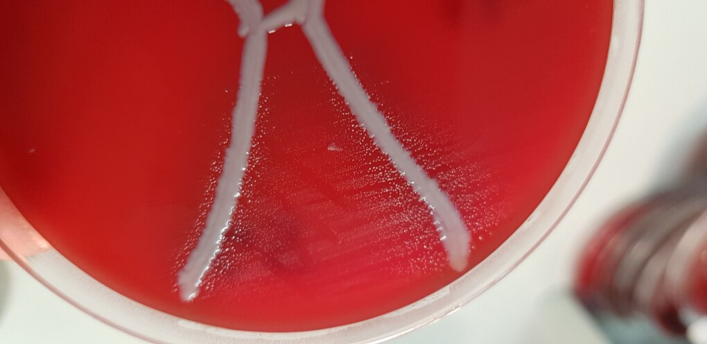 Lesions, abscesses and pleurisy - Australian scientists identify ...