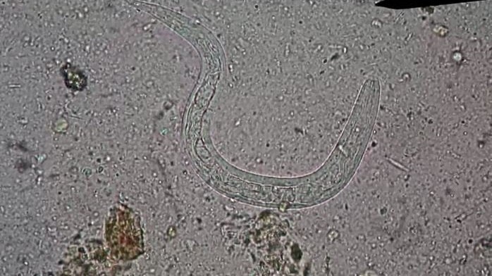 Parasitic worm endangering Indigenous communities in northern Australia ...