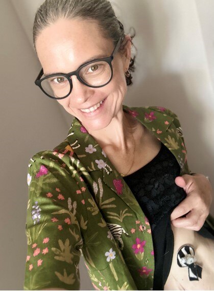 Juliette gets most of her nutrition through a feeding tube. Dietitians ...