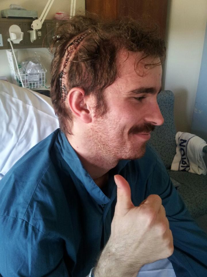 Brain tumour inspires national fencing champion to continue competing ...