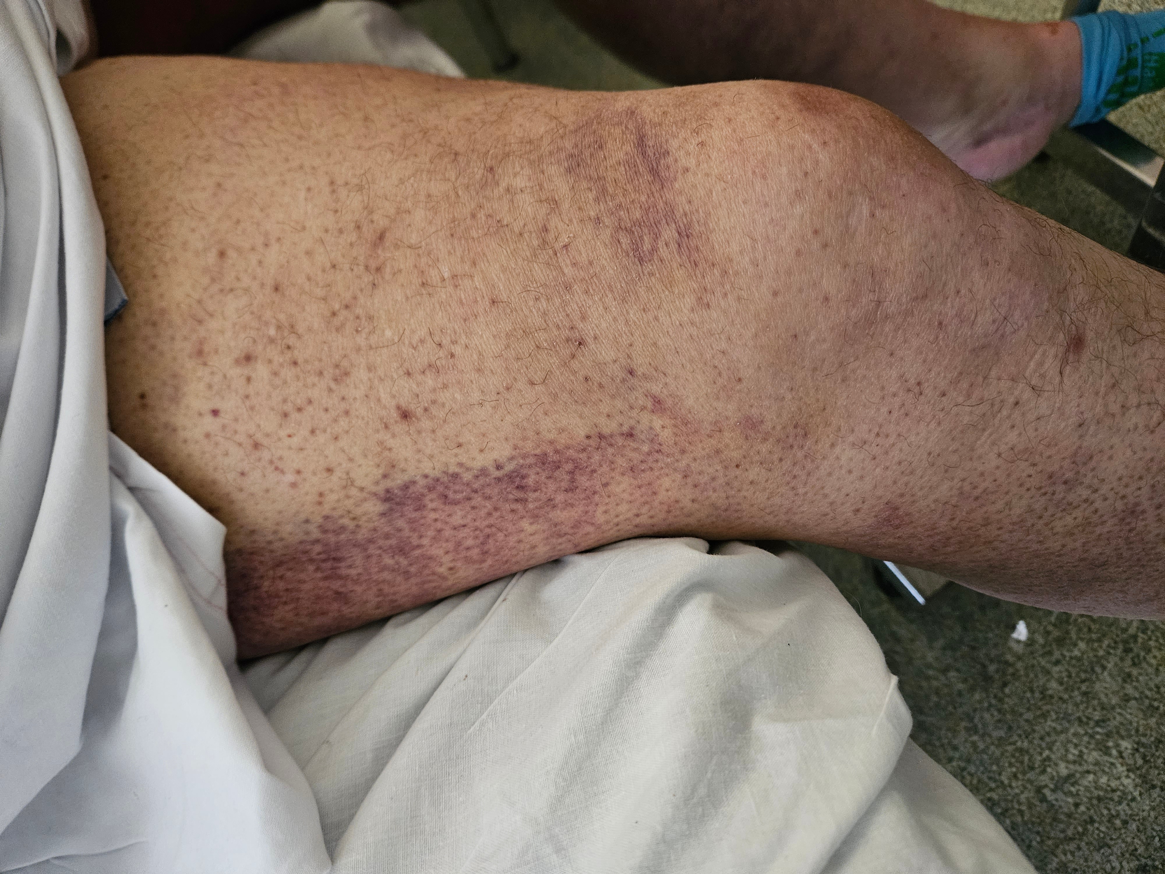 Diet and Nutrition - Topic - ABC News