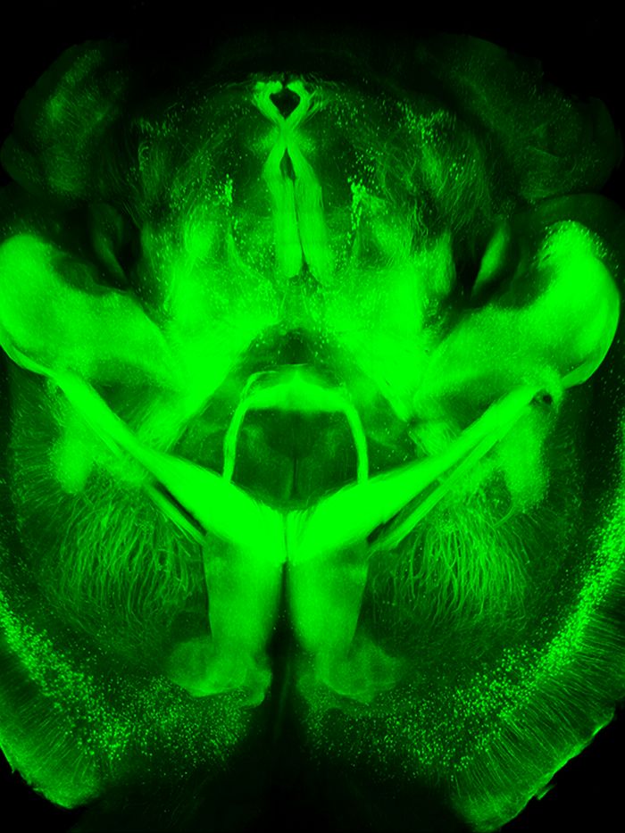 Top Australian brain surgeon makes appeal to Congress - ABC listen