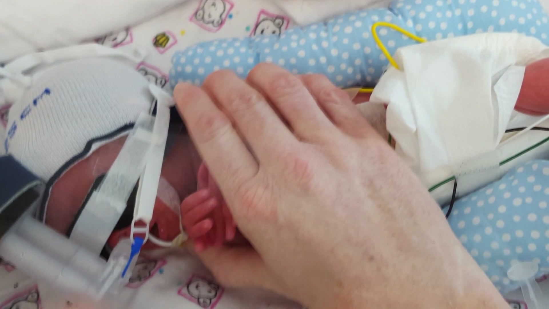 Baby Angus was born about 12 weeks early at the Royal Brisbane and ...