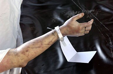 Doug Hendrie - ABC News