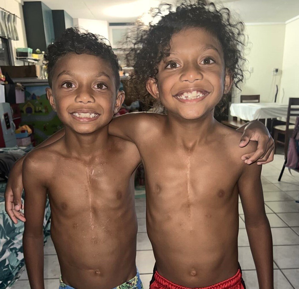 Twins Benson, Albert Tass thrive after open heart surgery at Queensland ...