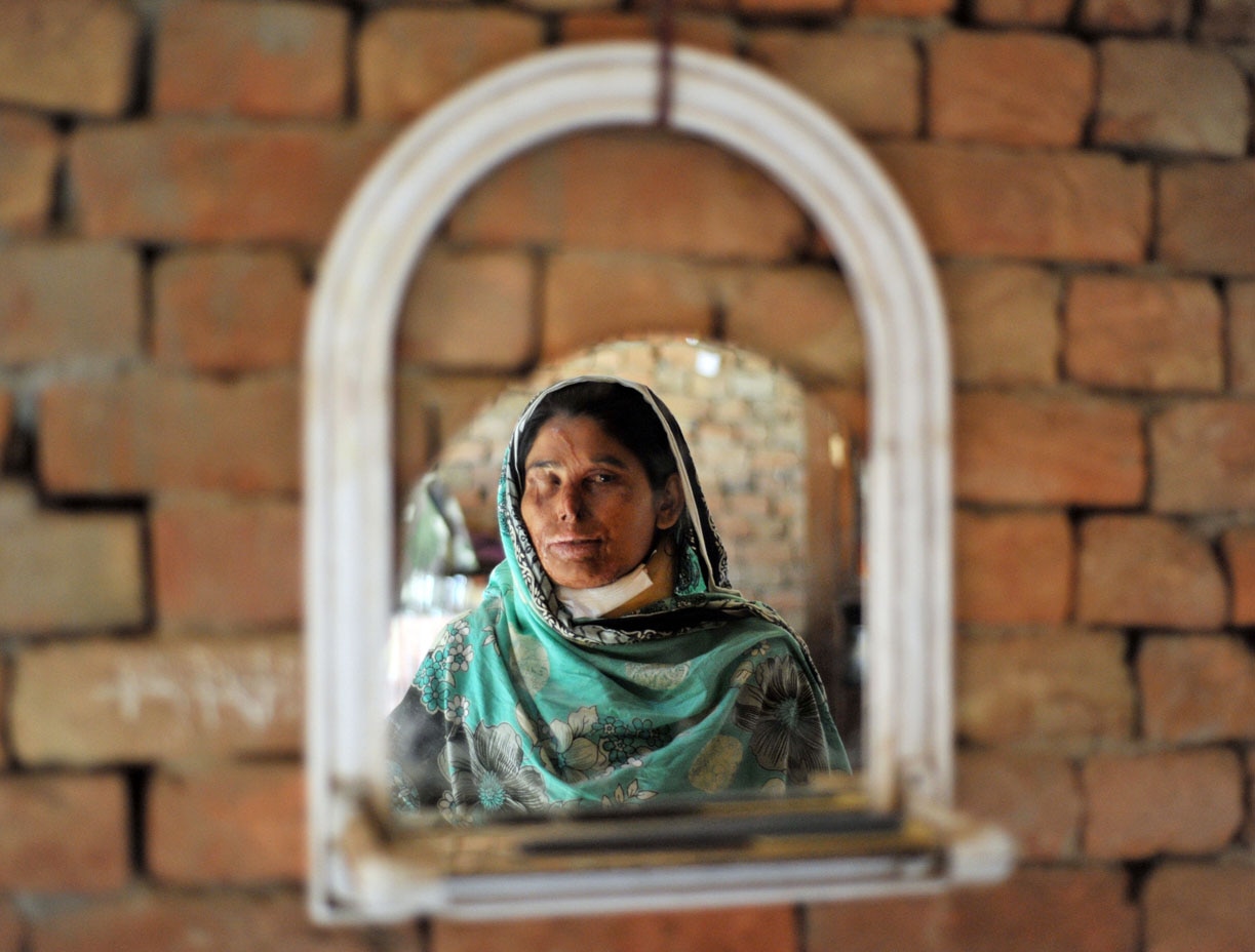 Hope for Pakistani acid attack victims - ABC Radio National