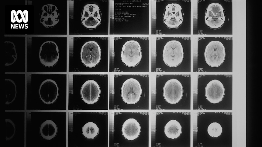 Australian National University researchers develop AI tool to classify ... Australian National University researchers develop AI tool to classify ...