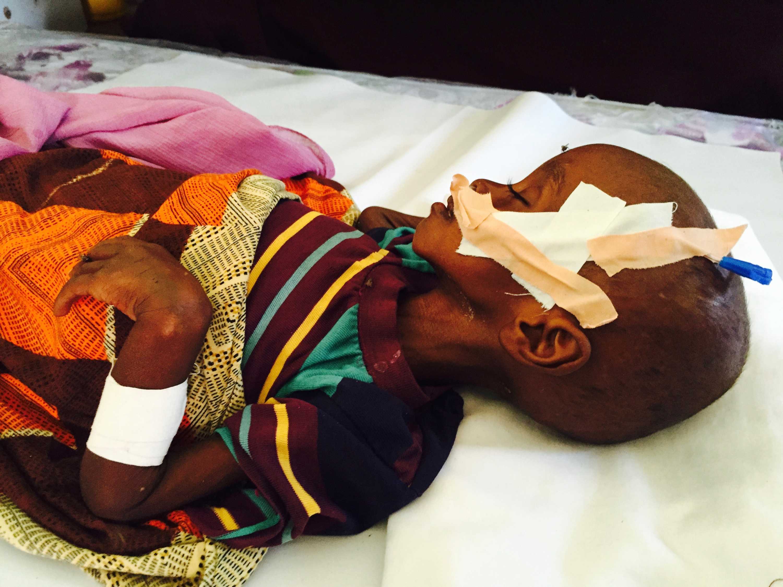 In a time of plenty, she dies of hunger - ABC News