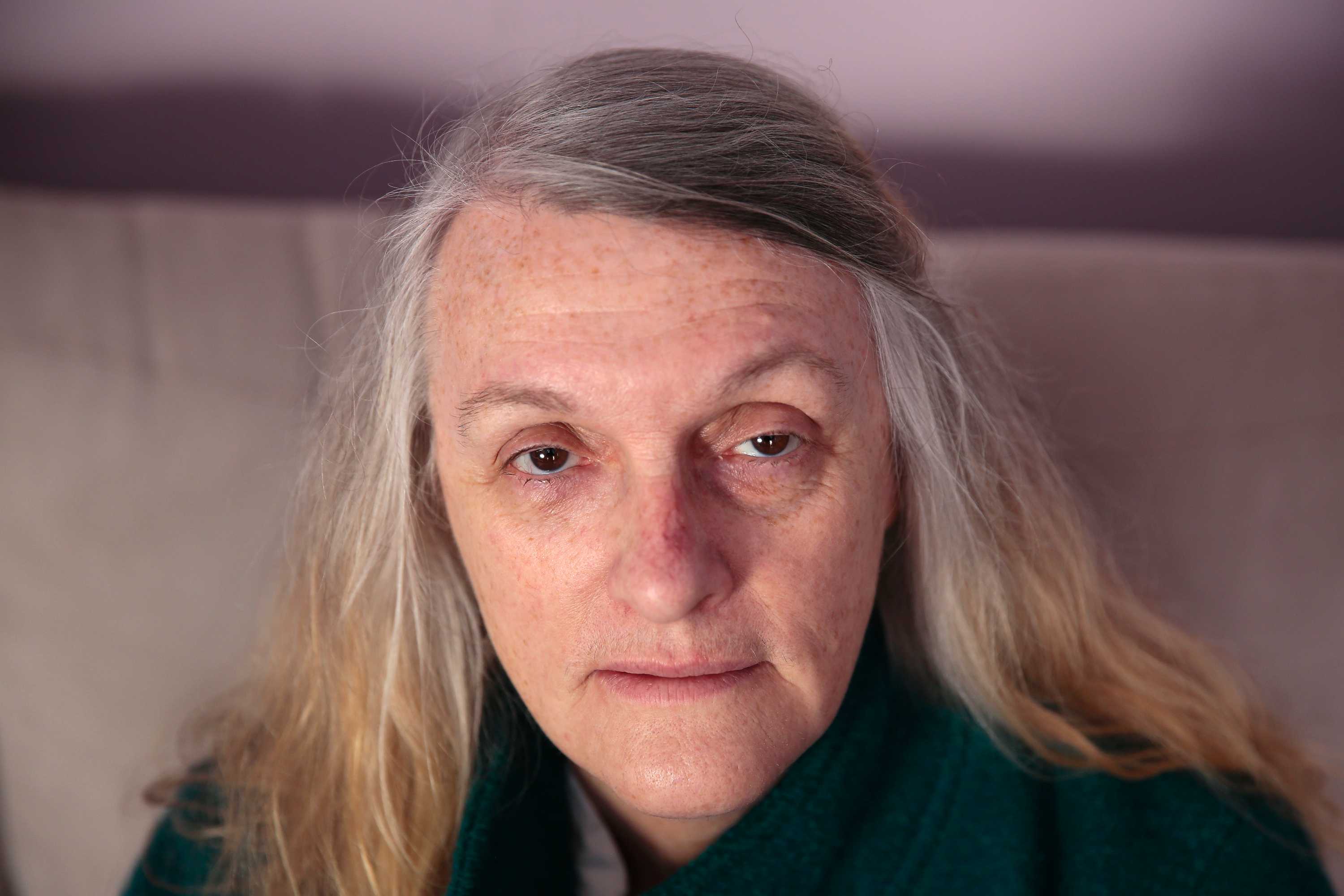 Life in the long shadow of cancer: Robyn's story - ABC News