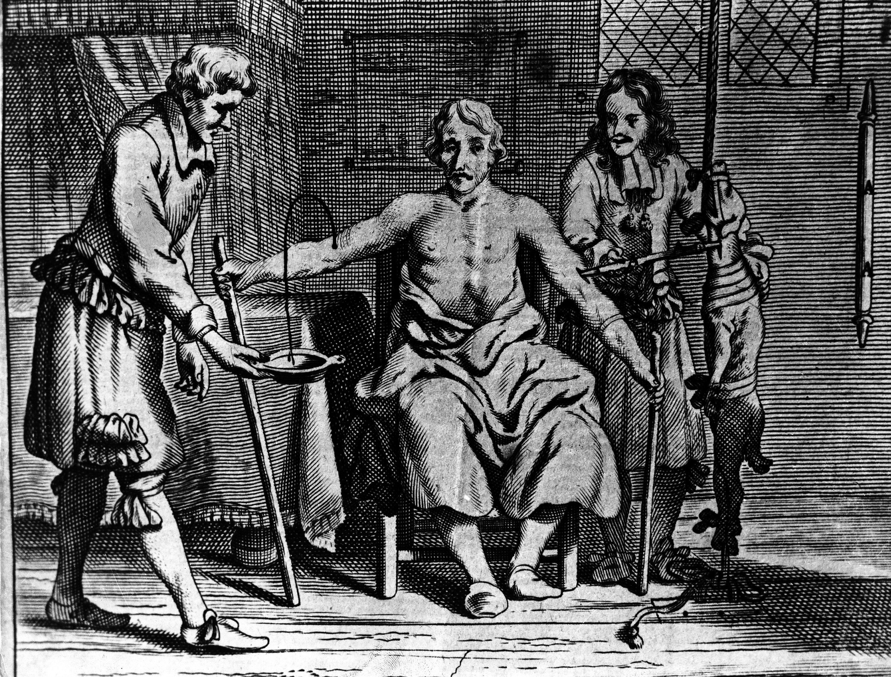 The bizarre history of medical transplants from Indian kings to stem ...