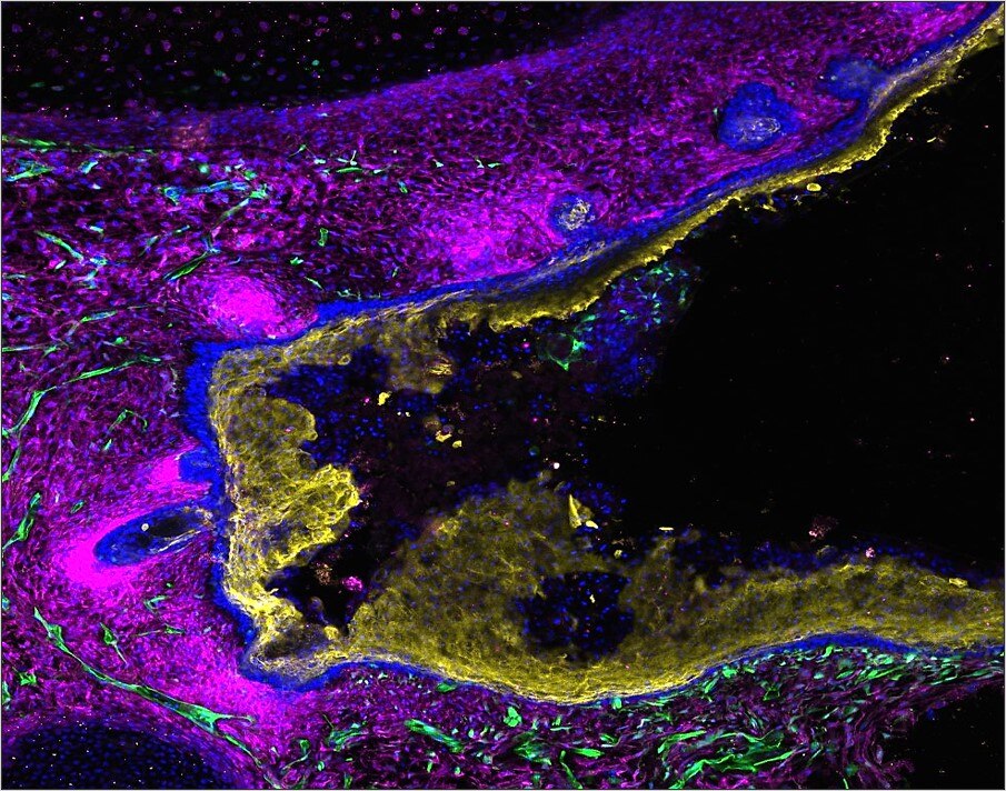 World-first living skin grown in Queensland laboratory - ABC News