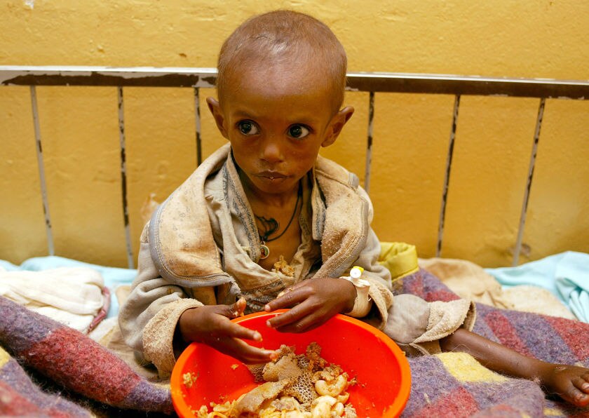 Starving Ethiopian Kids