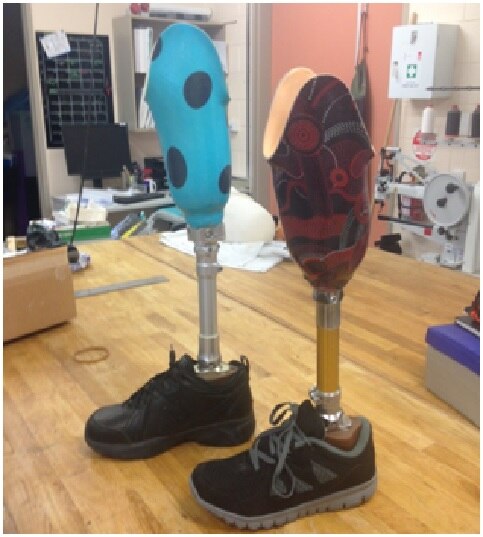 'Deadly legs' helping to take 'shame' out of prosthetics for Indigenous ...