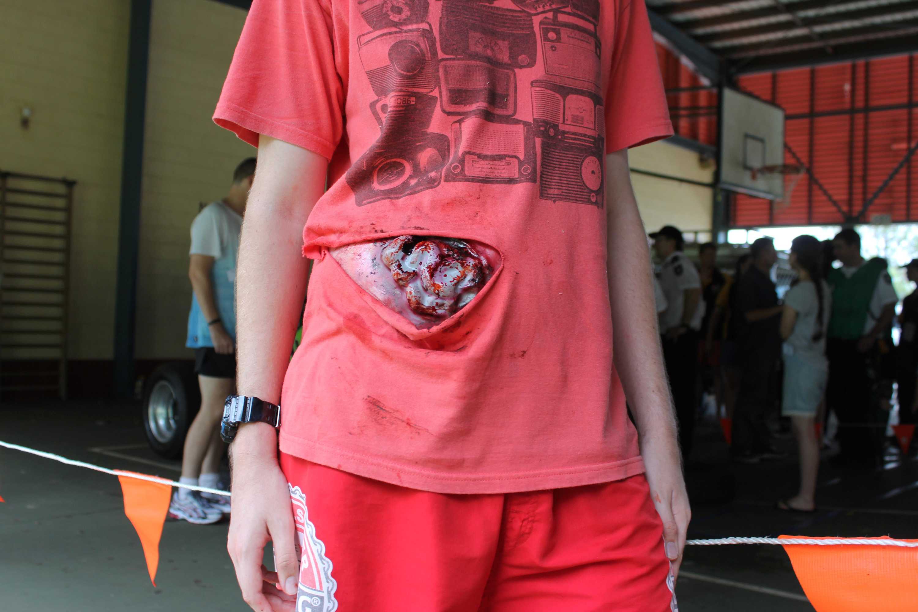 Northern Territory teens win St Johns cadet competition with fake blood ...