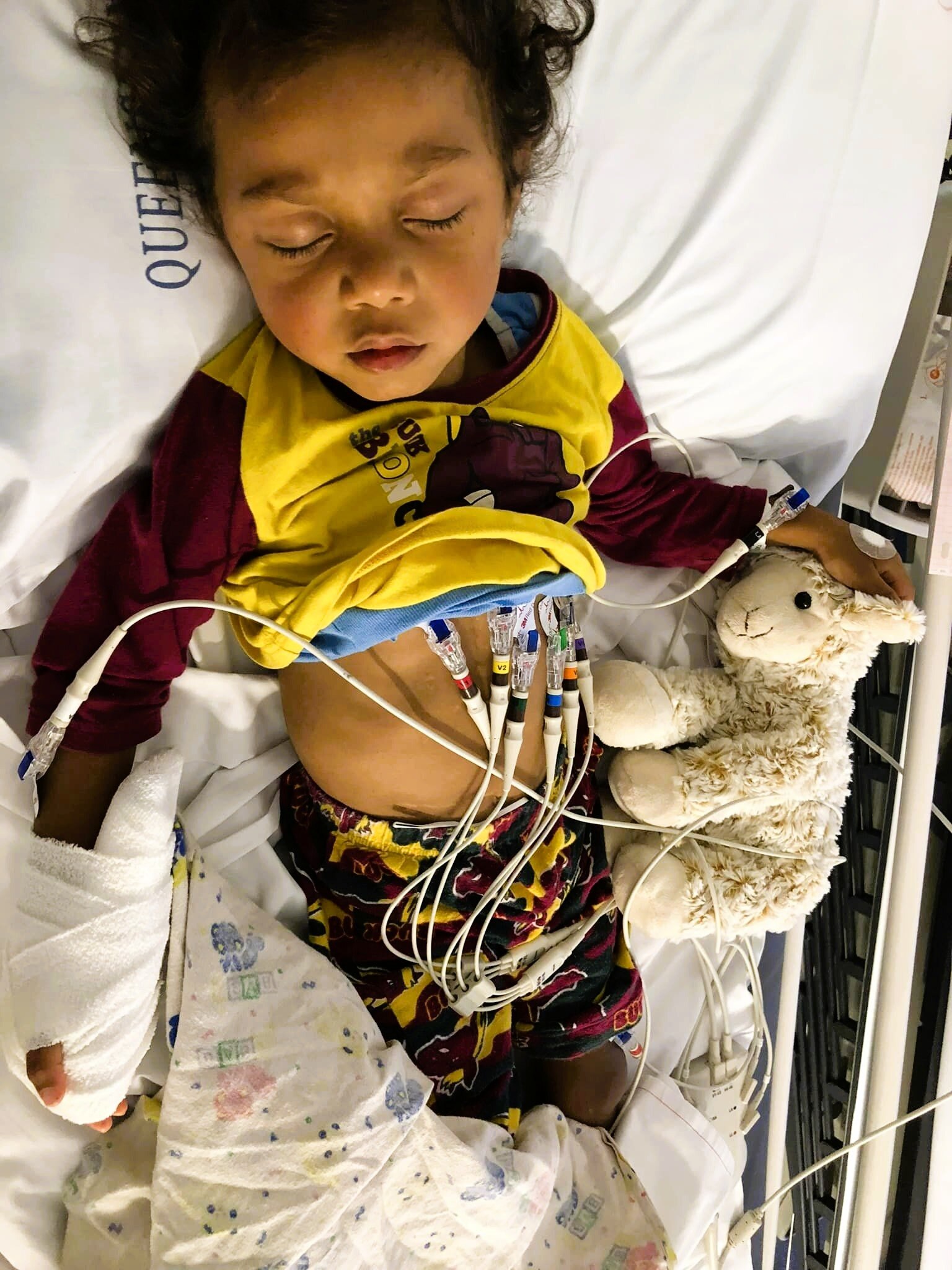 Twins Benson, Albert Tass thrive after open heart surgery at Queensland ...