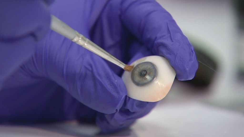 Meet an ocularist - ABC News