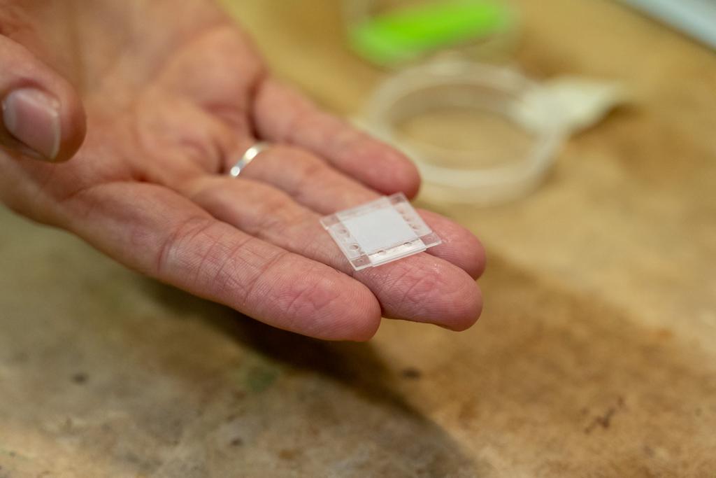 The world is running out of treatments for deadly infections, but an ...