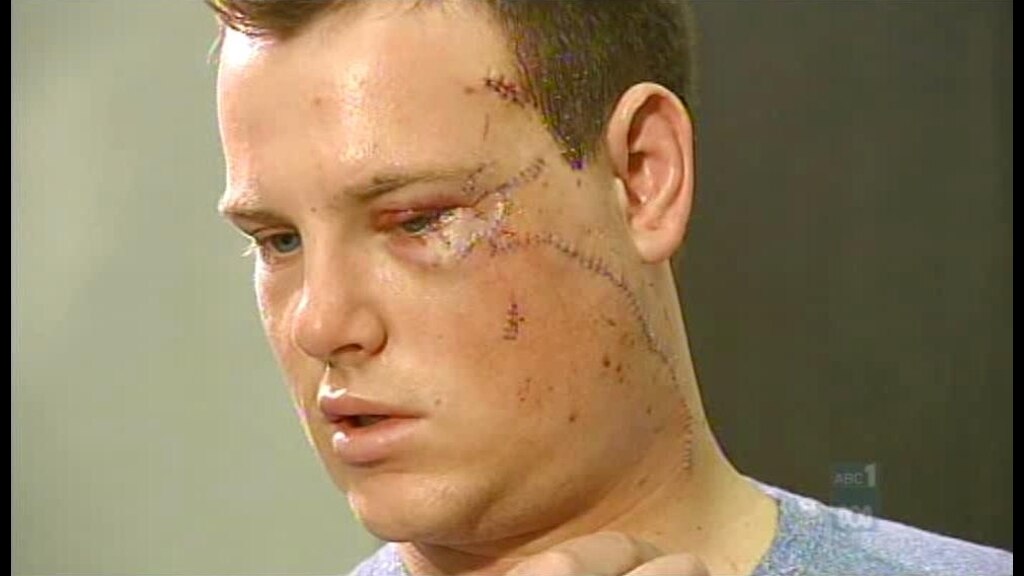 Man questioned over nightclub glassing - ABC News