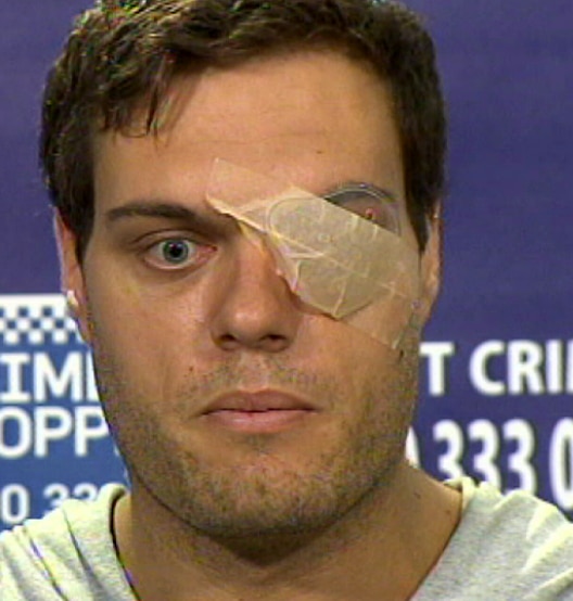 Perth man jailed over city bar bashing that blinded victim in one eye ...