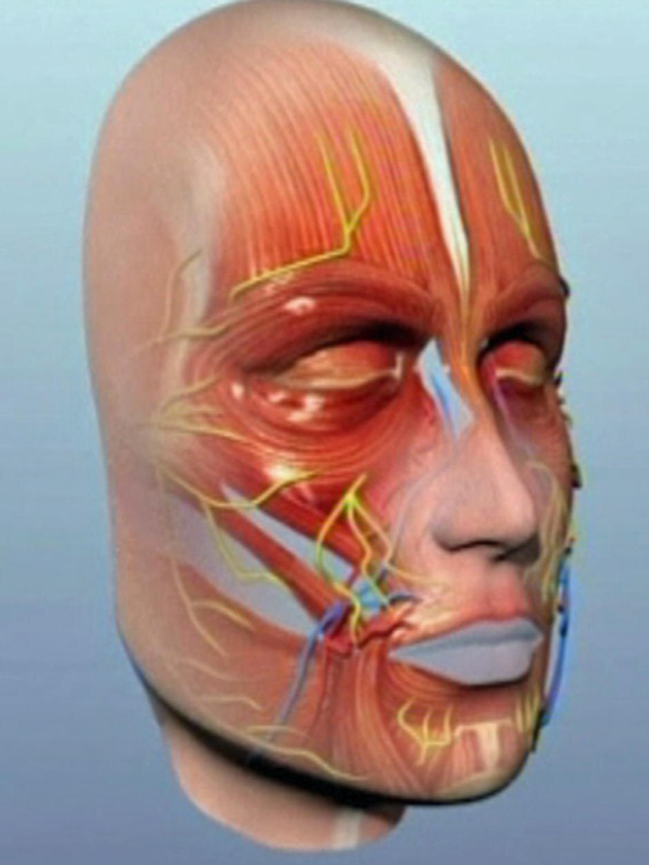 Mauled woman has full face transplant - ABC News