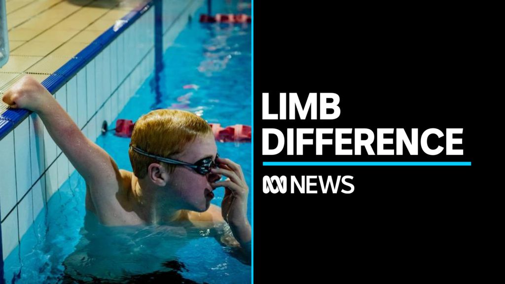 Our understanding of limb difference is changing - ABC News