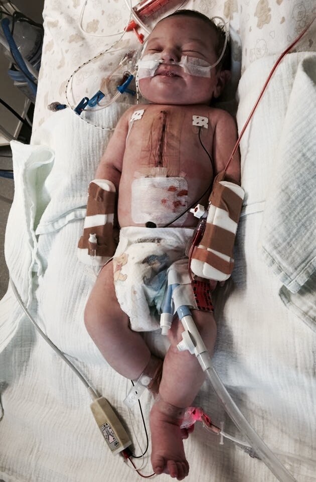 New research shines light on the formation of heart defects in babies ...