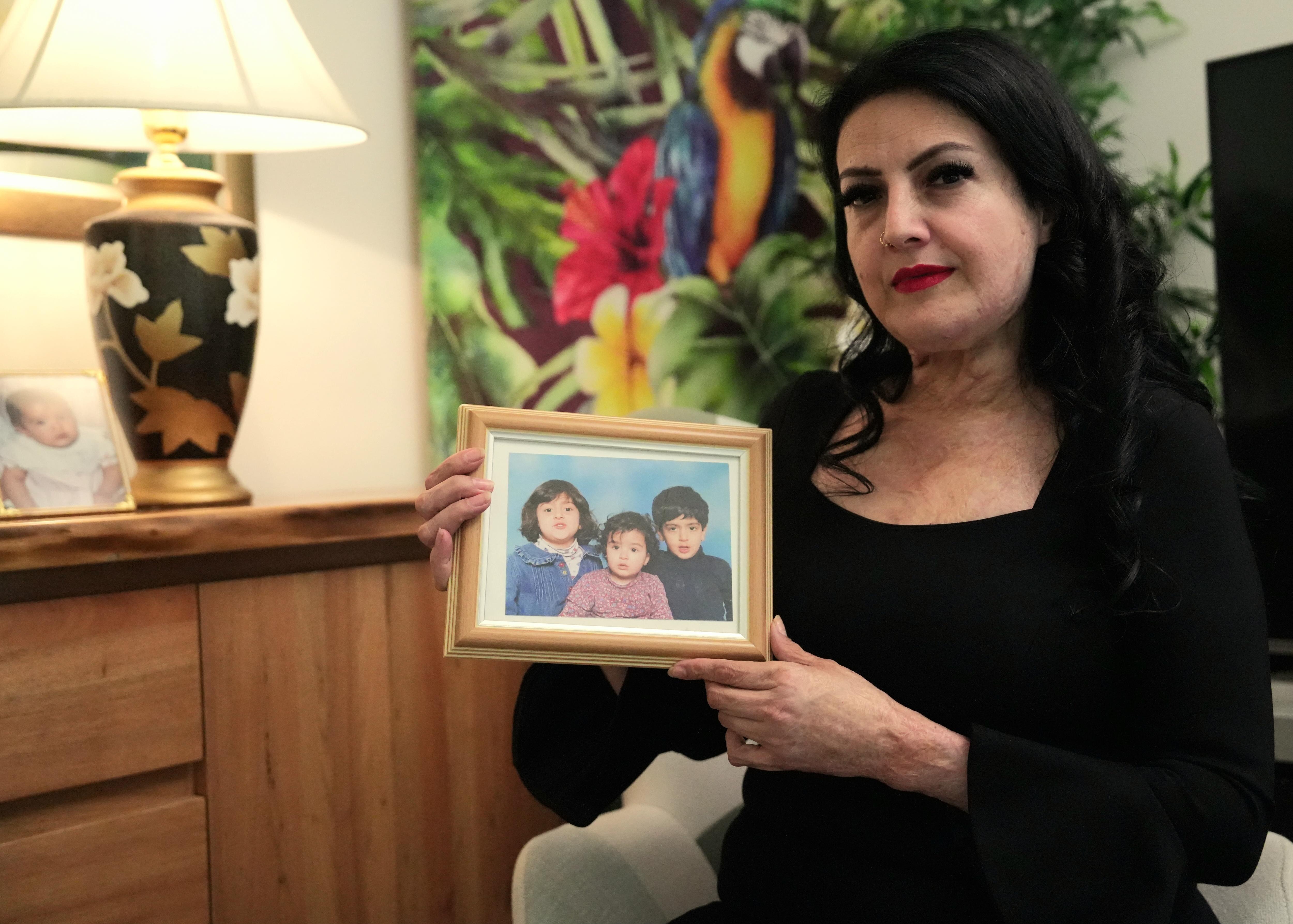 Reports of domestic violence burn injury cases likely 'tip of the ...