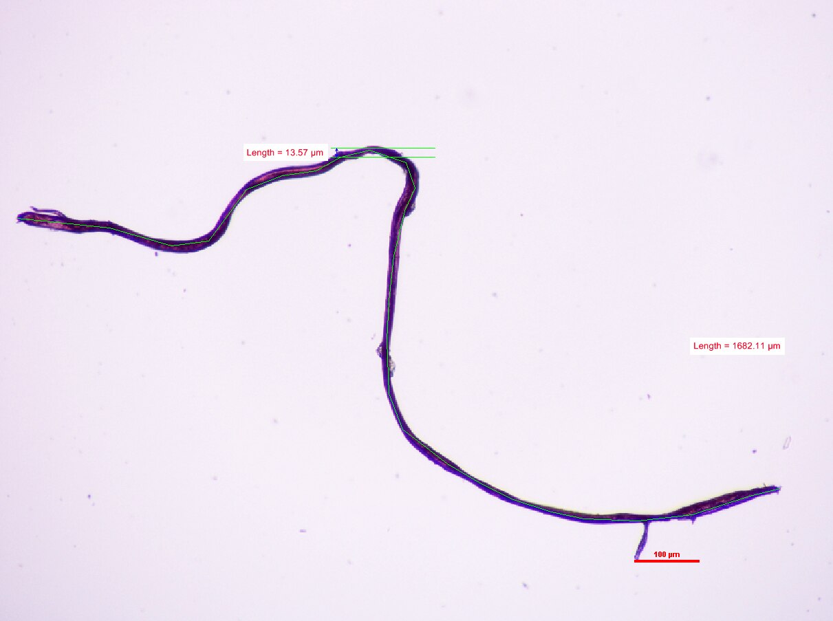 Microplastic pollution of seafloor widespread along Australia's south ...