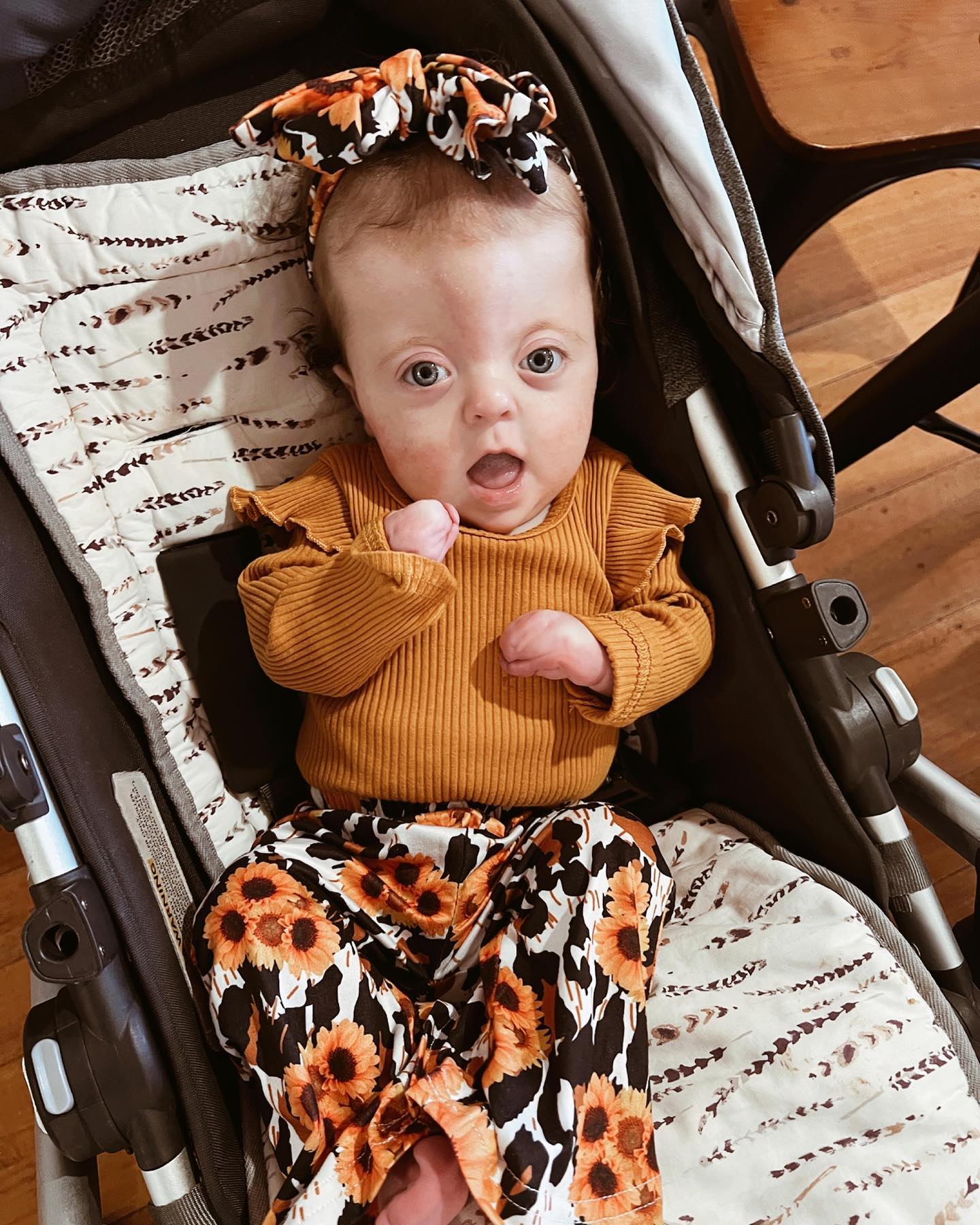 Surgeons will remove and then reconstruct a large part of Daisy's skull ...