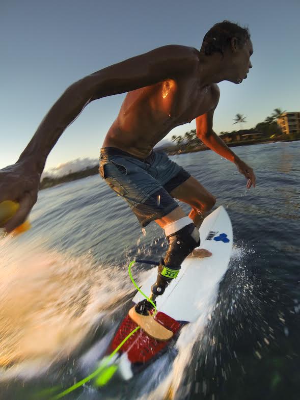 Hawaiian surfer attacked by shark vows to protect the creatures of the ...