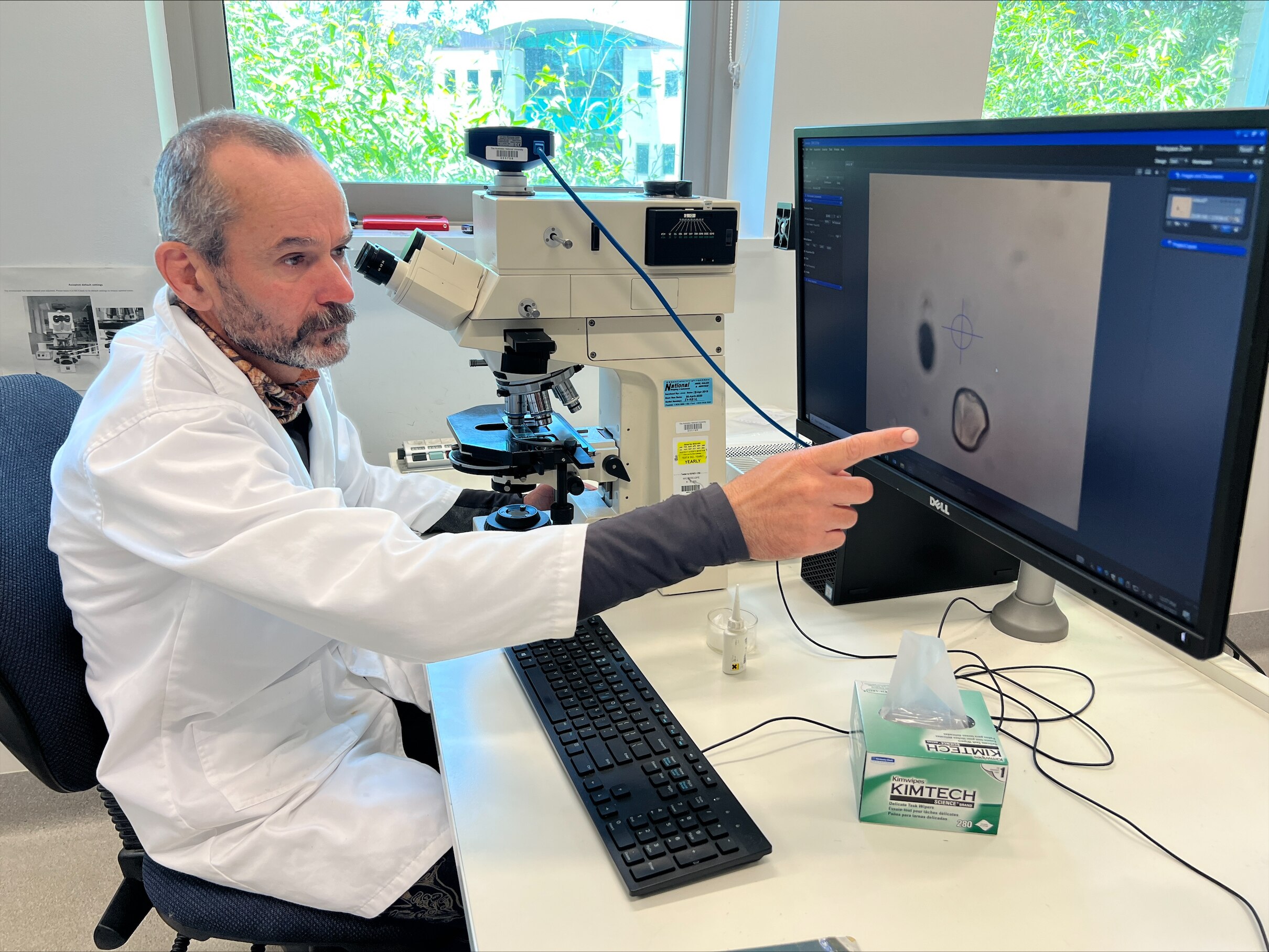 Canberra's extreme pollen season breaks all records, triggers spike in ...