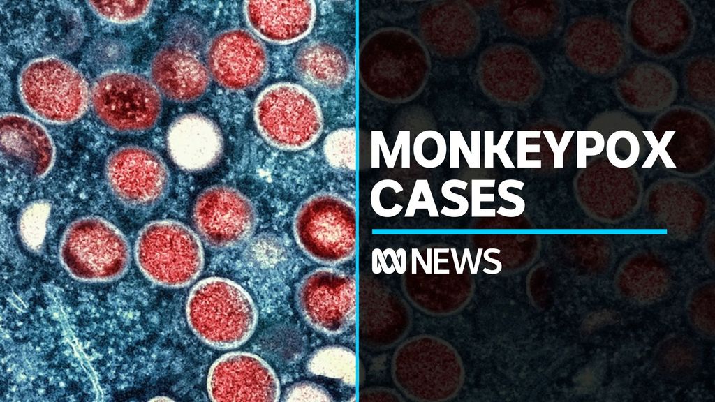 NSW records its first known case of local monkeypox transmission - ABC News