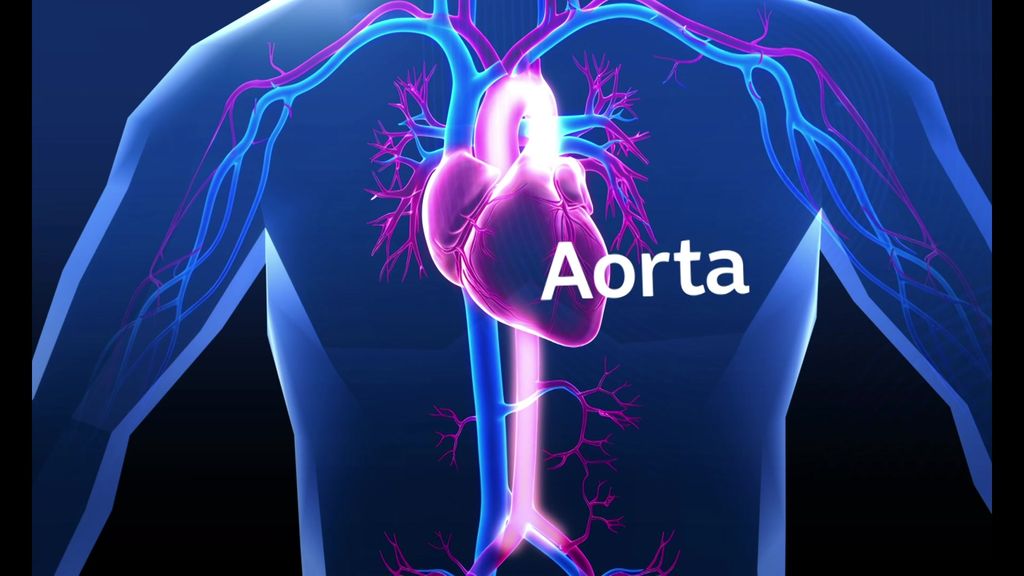 The aorta is the main artery coming off the heart and supplies blood to ...