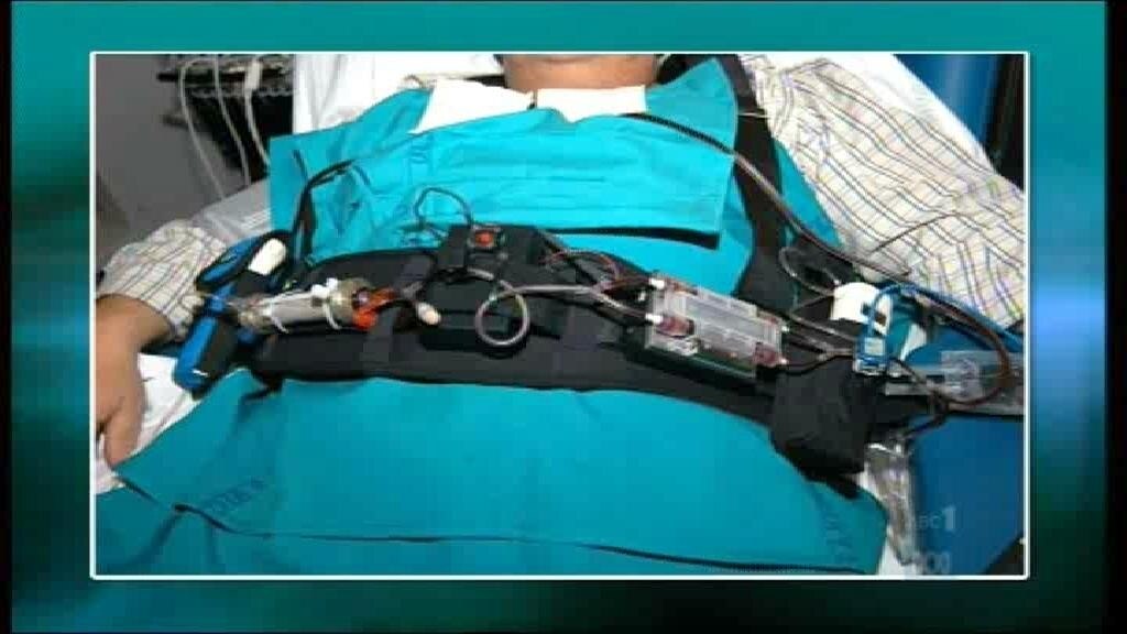 Portable kidney breakthrough - ABC News