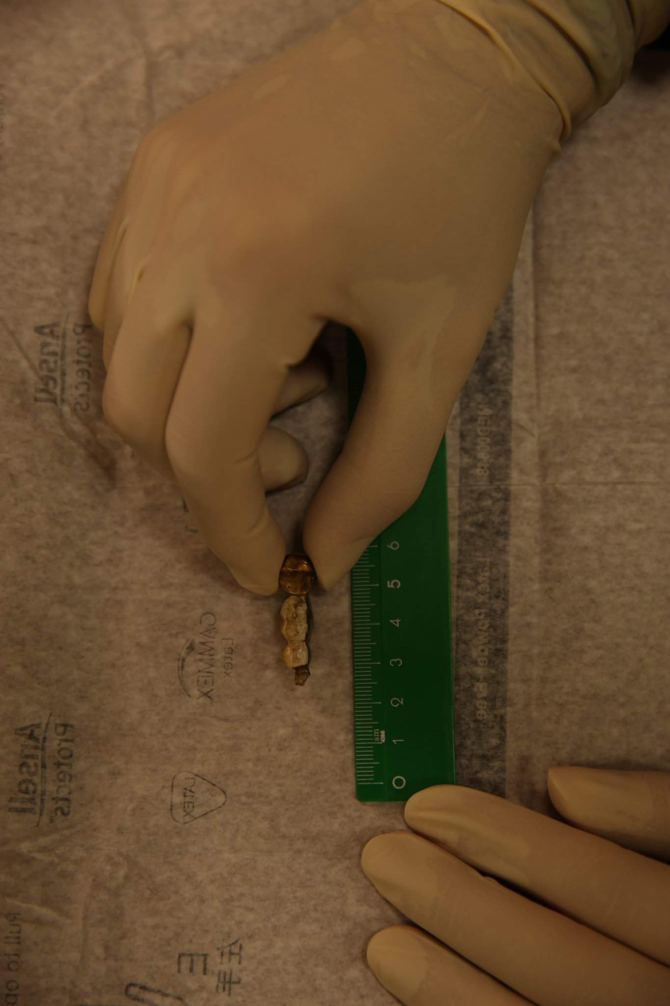 Adolf Hitler's teeth debunk conspiracy theories over death, scientists ...