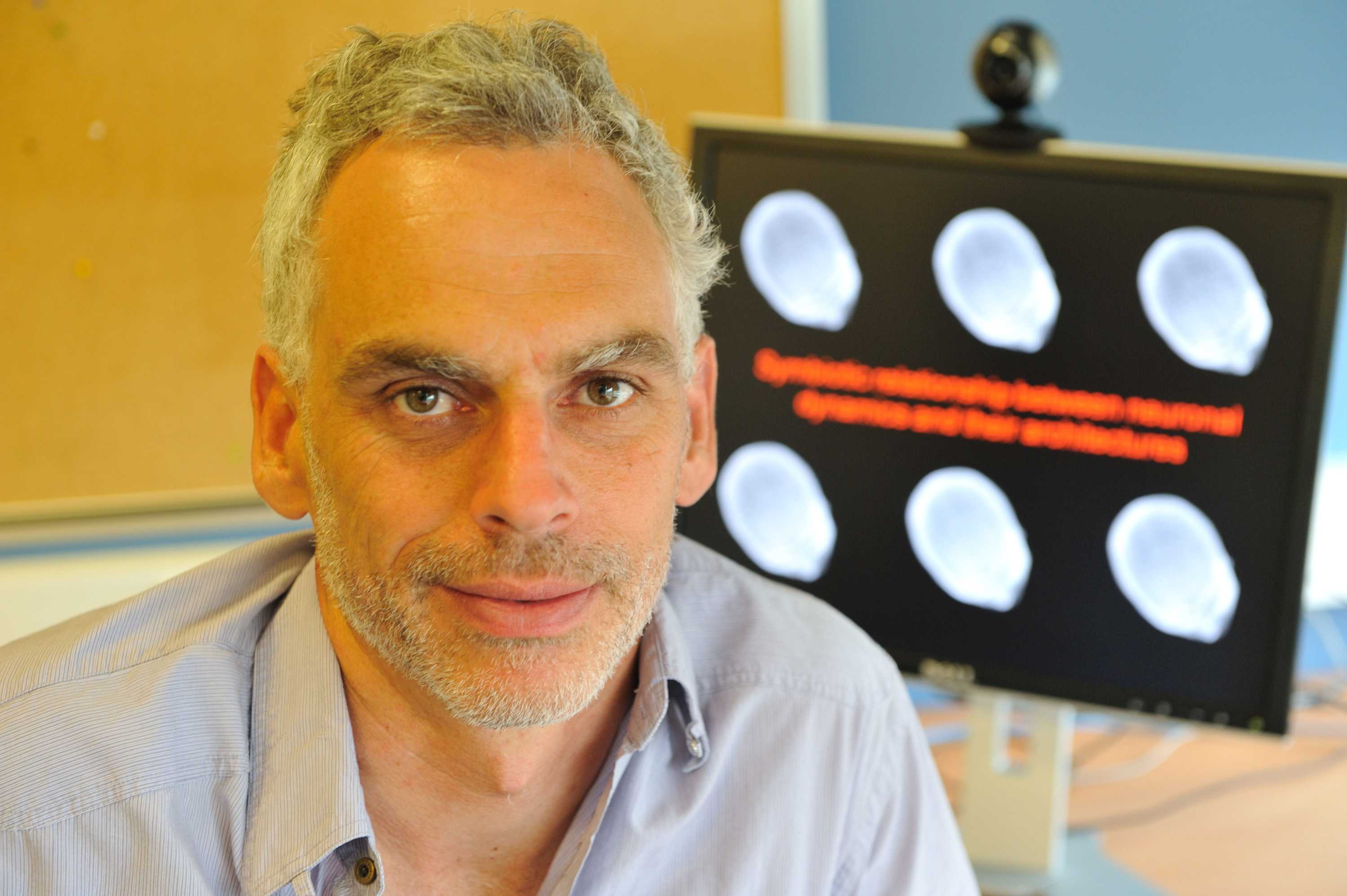 Baby brain study identifies health problems in premature infants - ABC News