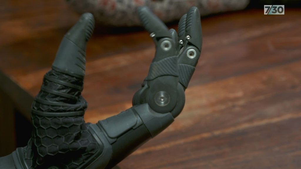 Futuristic and life changing bionic eyes and limbs becoming a reality ...