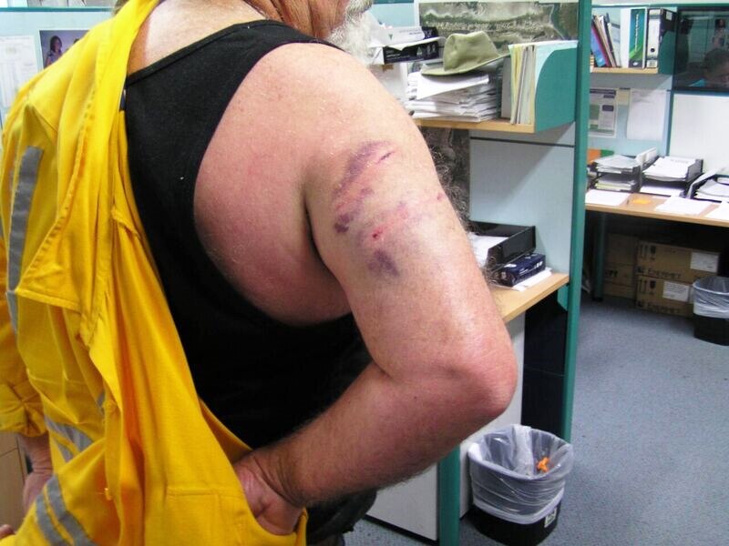 Dog attacks on electricity staff spark ban on reading meters across ...