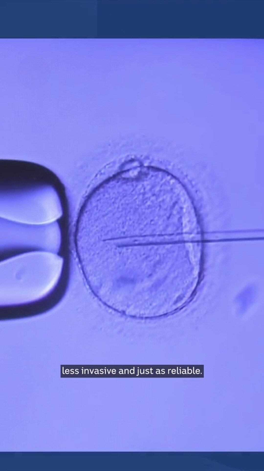 Fertility giant to pay $56 million - ABC News