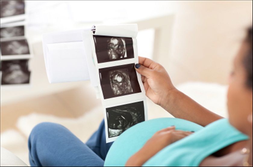 Foetal rights proposal passes NSW Lower House - ABC listen